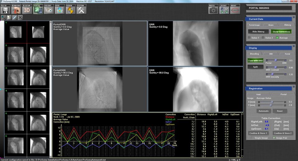 ProSoma 3D & 4D Simulation - Oncology Systems Limited