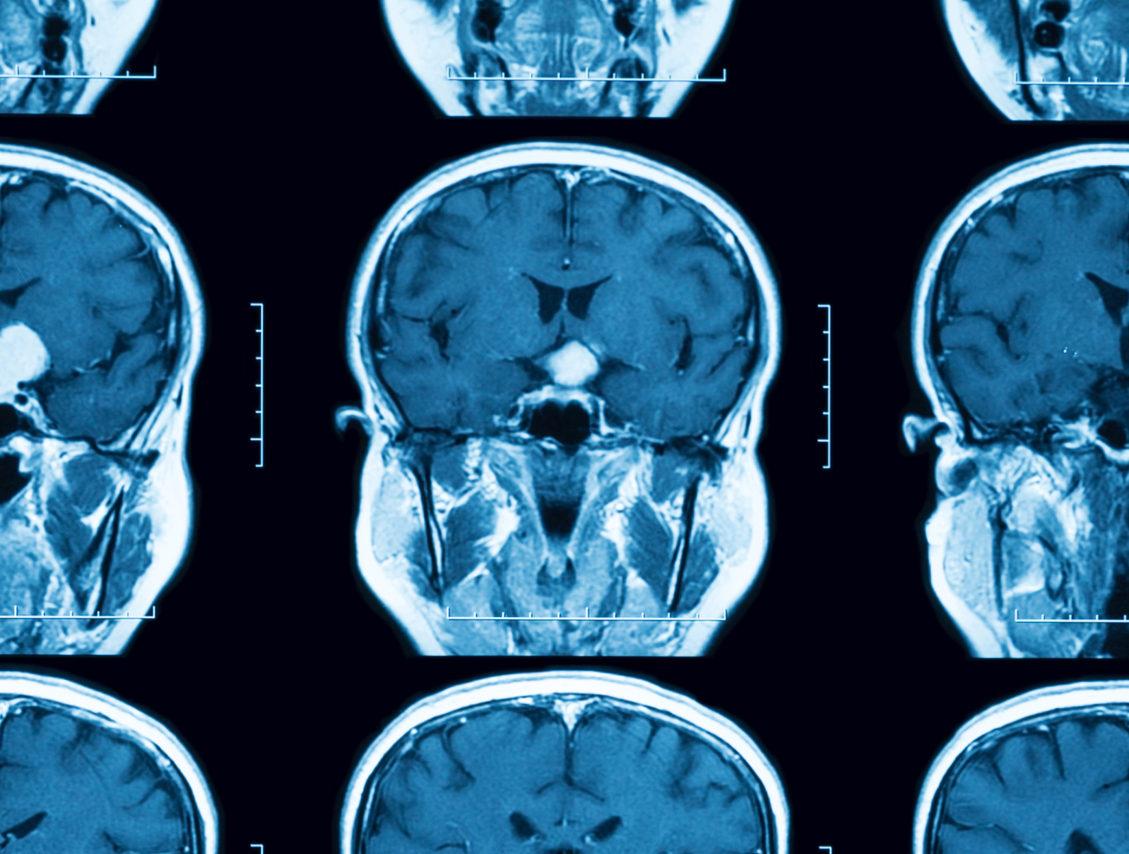 MRI Solutions - Oncology Systems Limited