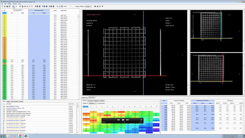 QUASAR™ GRID3D - Oncology Systems Limited