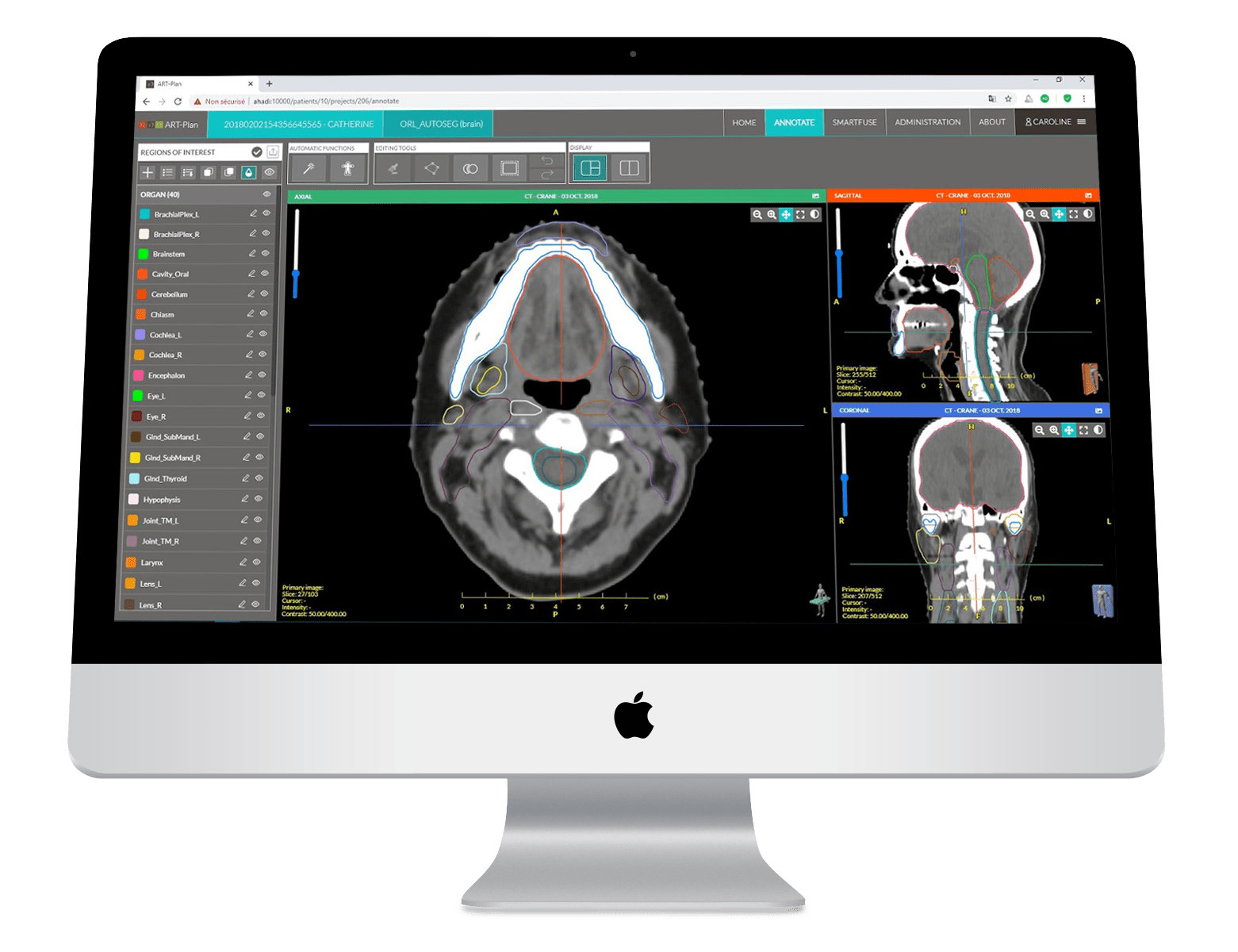 Software - Oncology Systems Limited