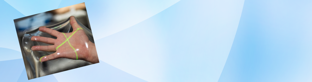 Clearsight Bolus - Oncology Systems Limited